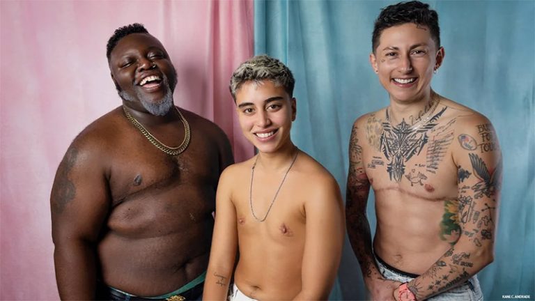 Transmen Empowerment through Trans tape: FTM Guide - Banabuddy FTM Packers | Prosthetic Penis ...