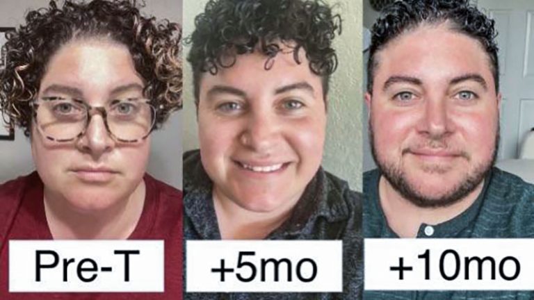 Understanding FTM Journey: A Comprehensive Guide - Banabuddy FTM ...