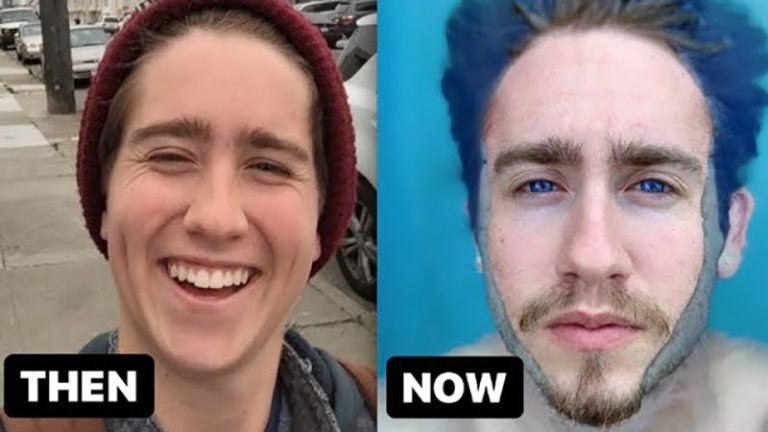 FTM Beard Growth Guide: Methods, Tips, and Personal Experiences ...