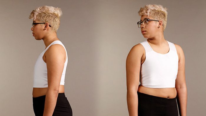 FTM Chest Transformation: How to Achieve a Male-Looking Chest ...