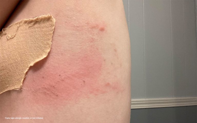 The Ultimate Guide to Trans Tape for Chest Binding - Banabuddy FTM Packers | Prosthetic Penis ...