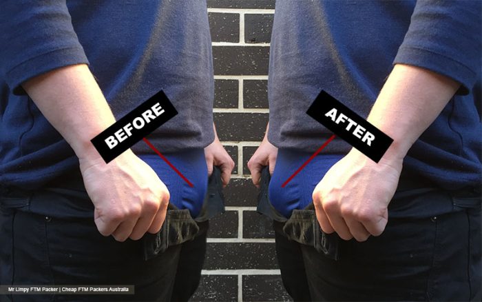 How to Wear a Packer: A Comprehensive Guide for FTM Individuals ...