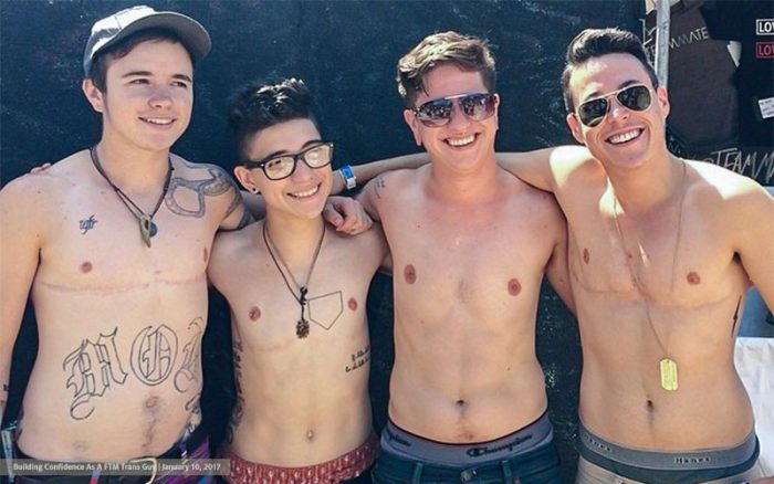 Is It Too Late to Transition? Embracing Your FTM Journey at Any Age - Banabuddy FTM Packers ...